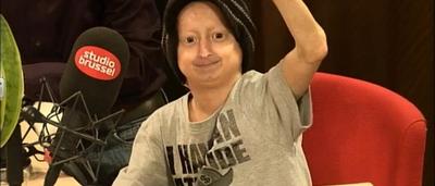 Michiel, l’enfant Progeria, est désormais DJ et animateur radio ...