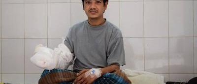 Après 16 opérations, «l’homme-arbre» peut à nouveau utiliser ses mains ...