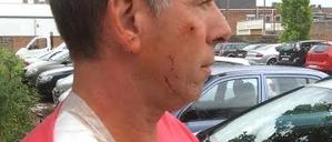 Eric Renson, candidat VLC à la Région, agressé au couteau à Waremme ...